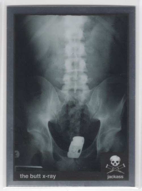 2022 Zerocool Jackass Stunts Silver #s3 the butt x-ray - NM-MT